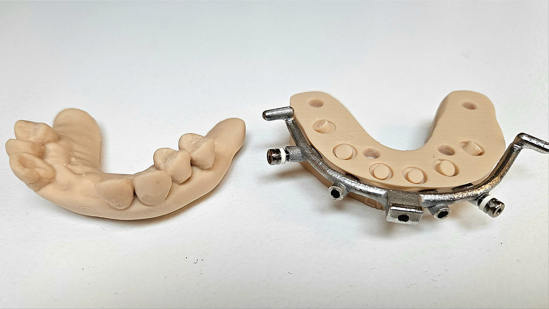 SILOADED – Full Arch Fully Guided – Southern Implants